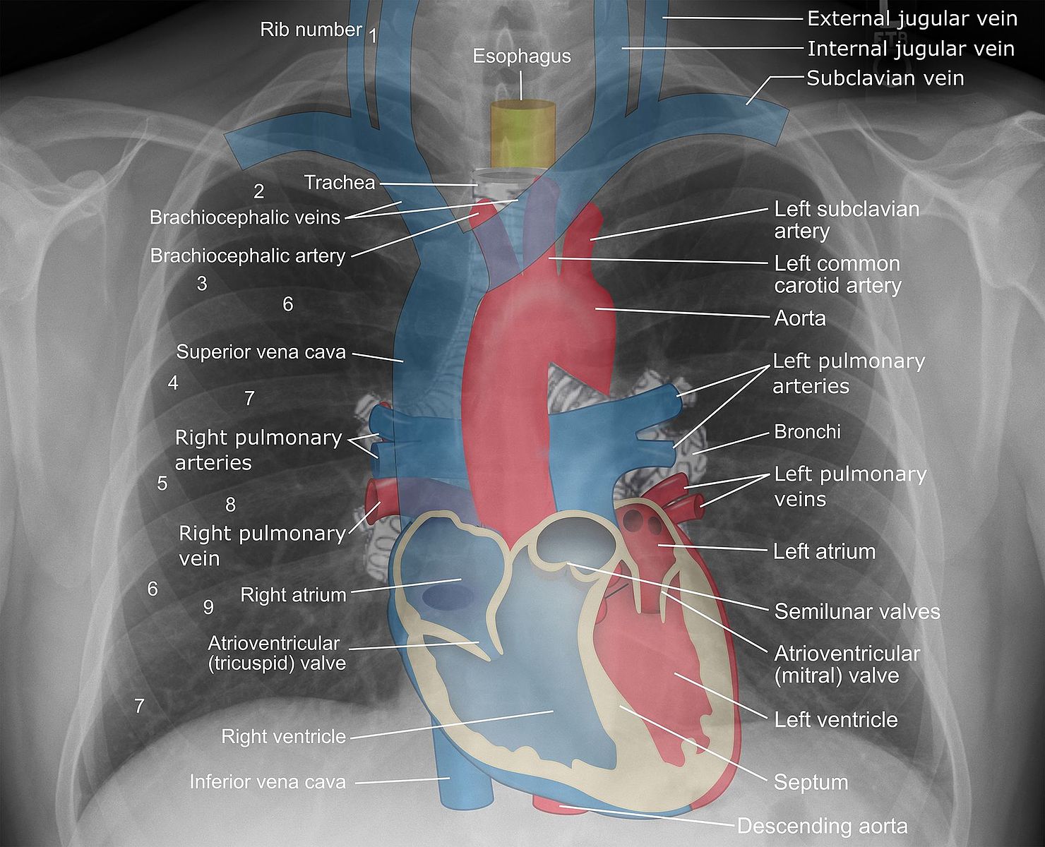 Plain Film X Ray Principles Interpretation TeachMeAnatomy