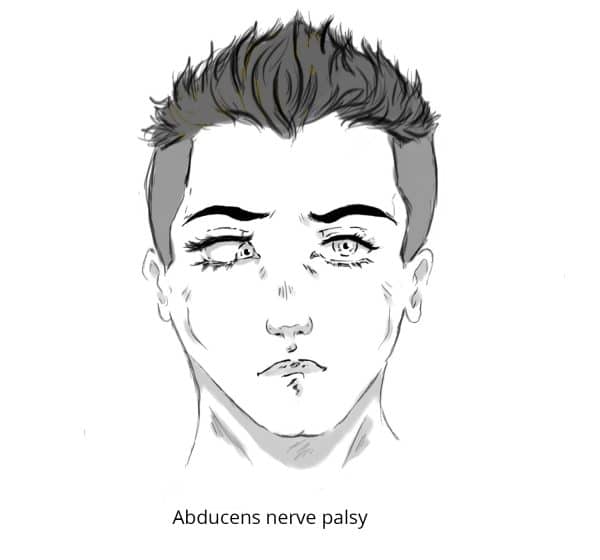 The Abducens Nerve (CN VI) - Course - Motor - TeachMeAnatomy