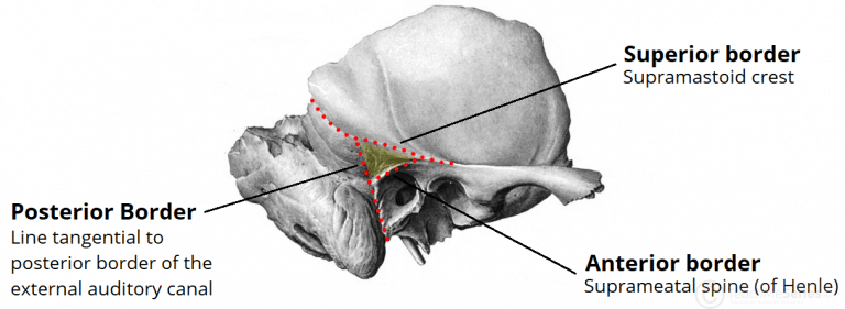 The Mastoid Fossa - MacEwen's Triangle - Borders - Contents ...