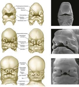 Development of the Face - Nose - Palate - Cleft Lip - TeachMeAnatomy
