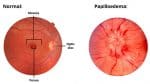 The Eyeball - Structure - Vasculature - TeachMeAnatomy