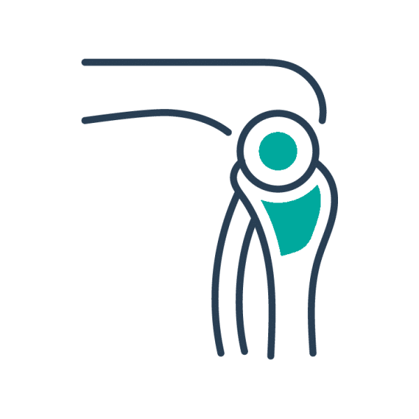 Joints in Human Anatomy | Classification, Synovial Structure and ...