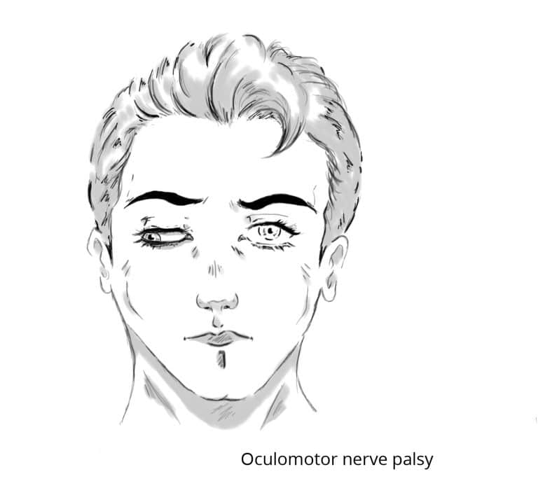 The Extraocular Muscles - The Eyelid - Eye Movement - TeachMeAnatomy