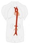 THE AORTA