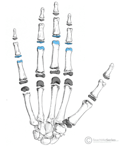 The Proximal Interphalangeal Joint - Articulation - TeachMeAnatomy