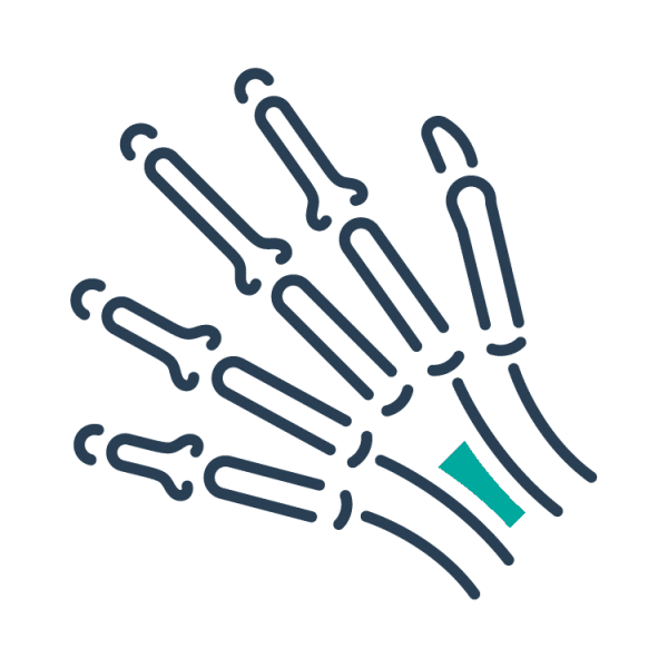 Upper Limb Anatomy | Shoulder, Arm, Forearm and Hand – TeachMeAnatomy