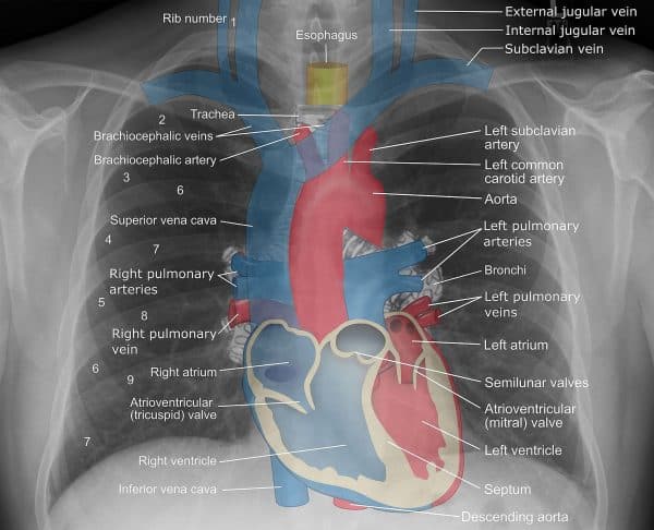 Imaging Modalities | X-Ray, CT and MRI Explained – TeachMeAnatomy