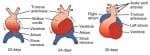 Development of the Cardiovascular System - TeachMeAnatomy